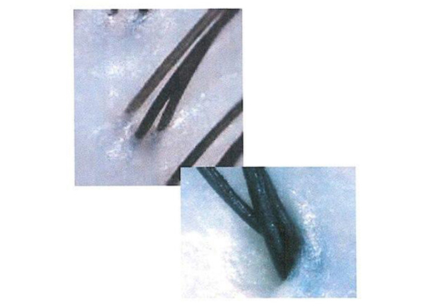 髪わざエンジェル│IB Castle