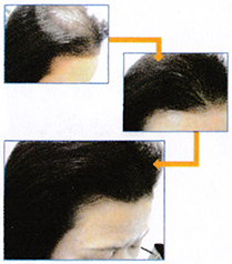 髪わざエンジェル│IB Castle