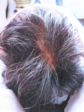 髪わざエンジェル│IB Castle